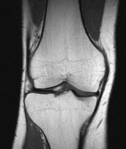 Dr Philippe LORIAUT Chirurgien Orthopédiste à Paris - Spécialiste du ...