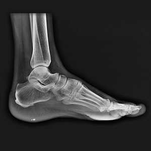 Dr Philippe LORIAUT Chirurgien Orthopédiste à Paris - Spécialiste du ...